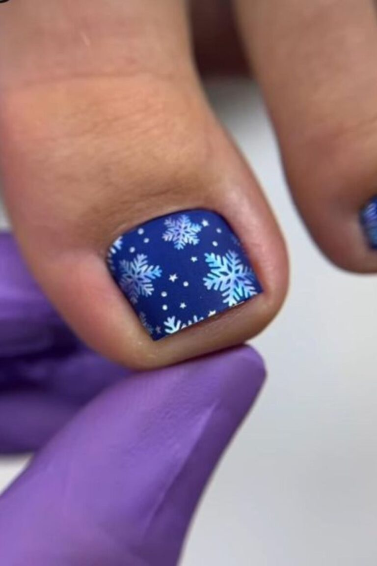 35 Winter Toe Nails to Keep Your Style Frosty and Fabulous